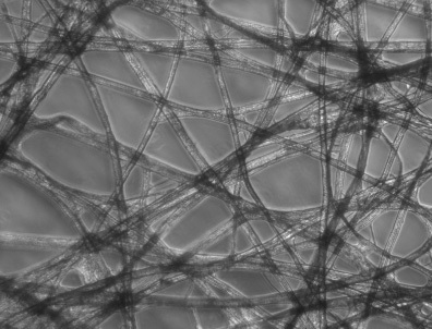 Optical Microscopy Application: Phase Contrast | 爱特蒙特光学